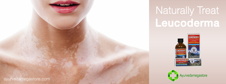 WHAT IS LEUCODERMA AND HOW AYURVEDA CAN CURE IT